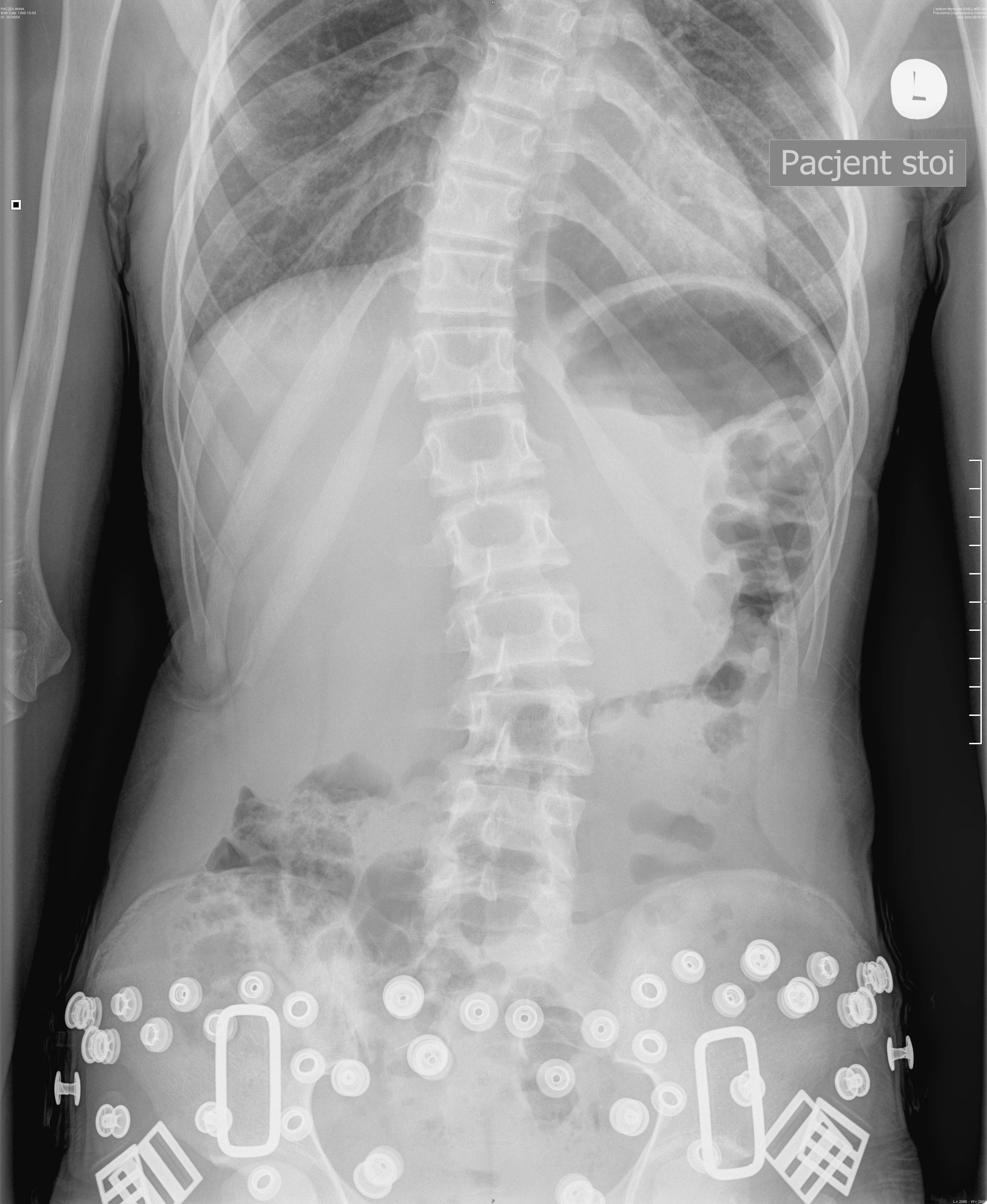 PACZEK ANNA_CR_20140906_90149_1 – Przychodnia Lekarska Nowy Chełm Sp. z ...